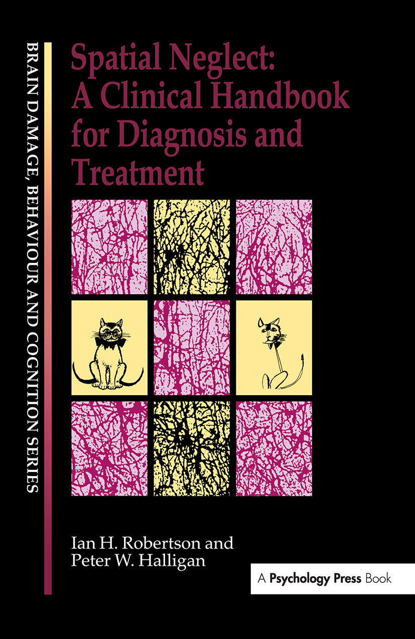 Spatial Neglect A Clinical Handbook For Diagnosis And Treatment Spatial Neglect A Clinical Handbook For Diagnosis And Treatment