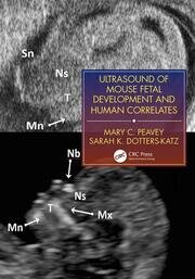 Ultrasound of Mouse Fetal Development and Human Correlates | Mary C. P